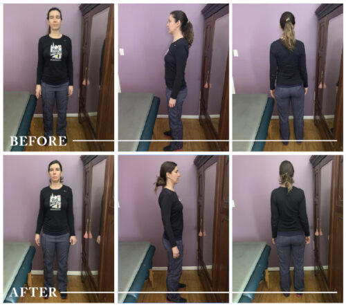 Charismata Health » Mechanical Link Therapy