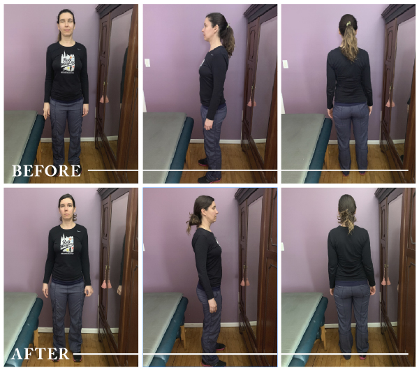 Charismata Health » Mechanical Link Therapy